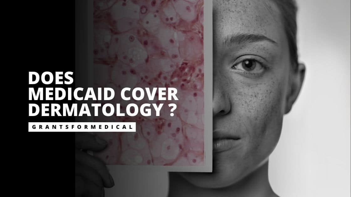 Does Medicaid Cover Acne Treatment? Does Medicaid Cover Acne Treatment?