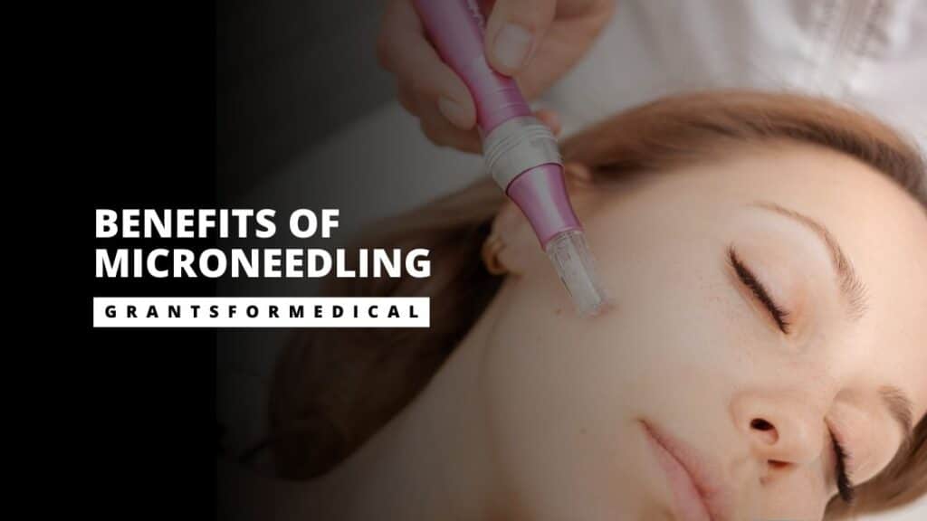 What is Microneedling? 5 Benefits Microneedling - Grants for Medical
