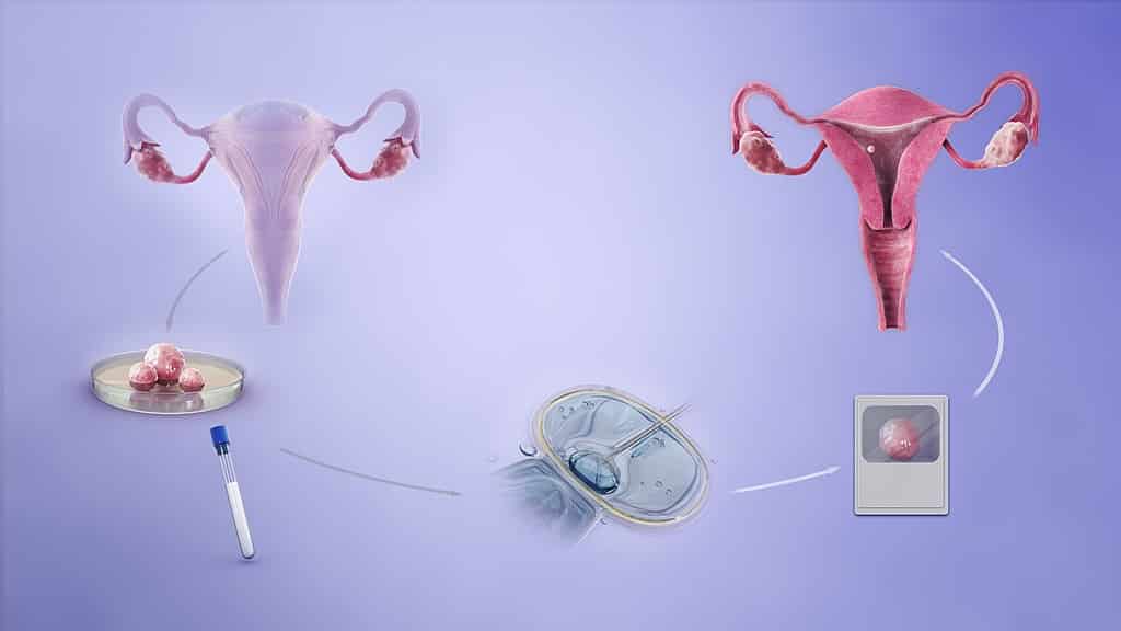 The Five Stages of IVF - Grants for Medical