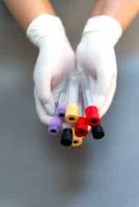 Magnesium Lab Values | Uses, Normal Levels