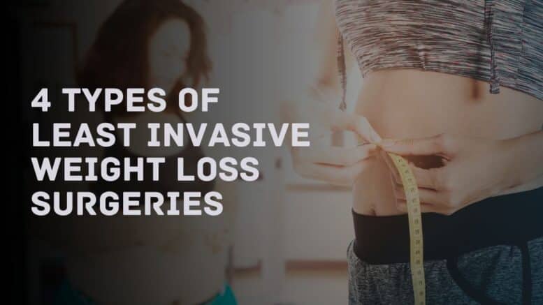 What is Least Invasive Weight Loss Surgery?