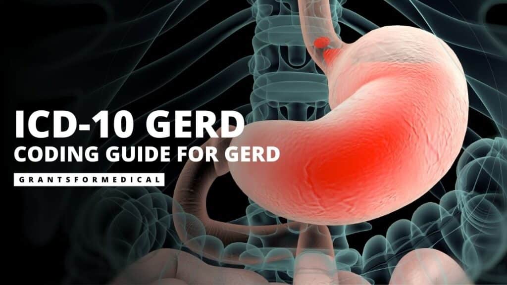 ICD-10 GERD | Coding Guide for GERD - Grants for Medical